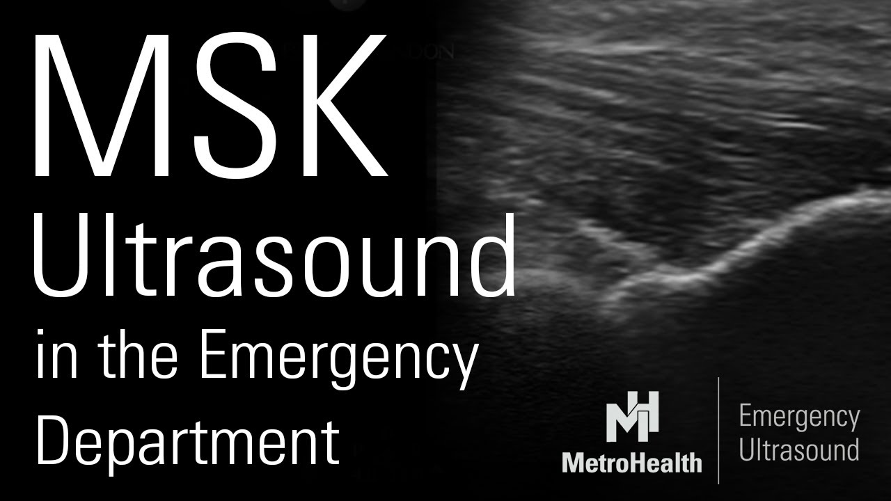 MSK Ultrasound - YouTube
