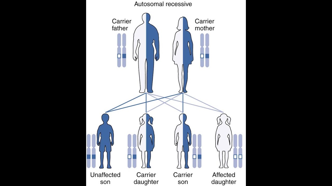Autosomal recessive disorders | Modes of Inheritance | USMLE step 1 ...