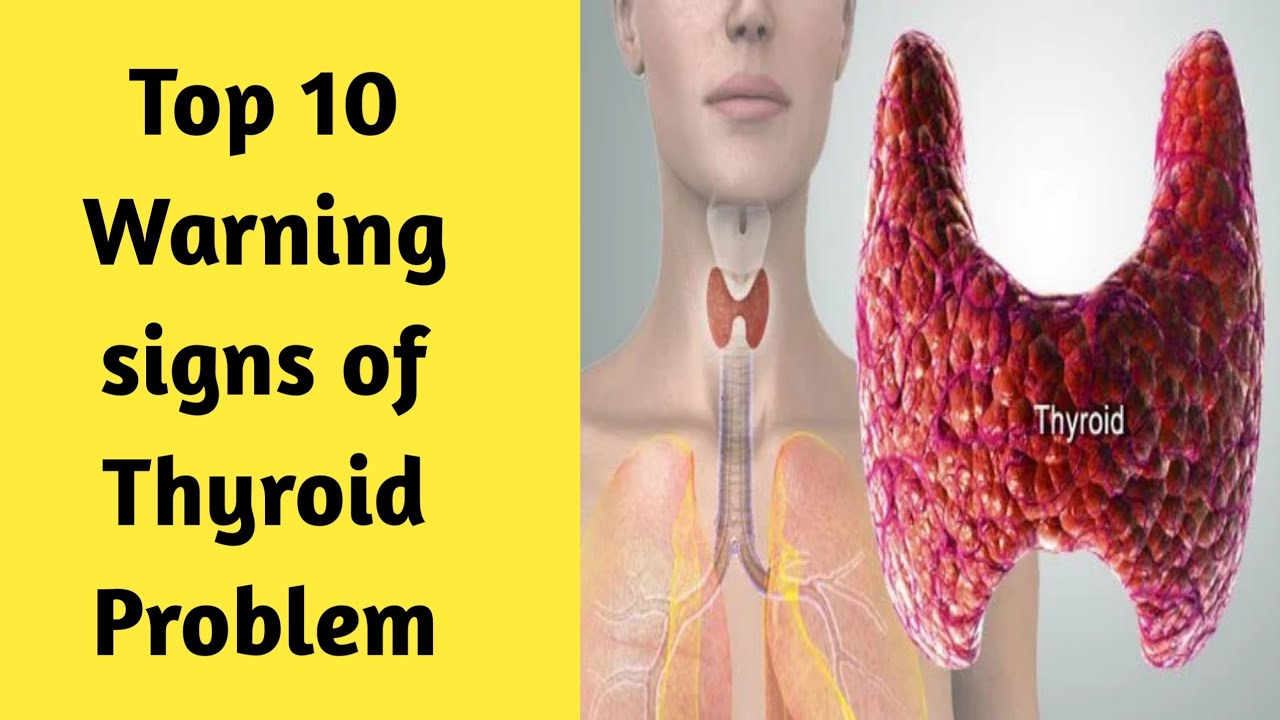 Top 10 Warning signs of Thyroid Problem - YouTube