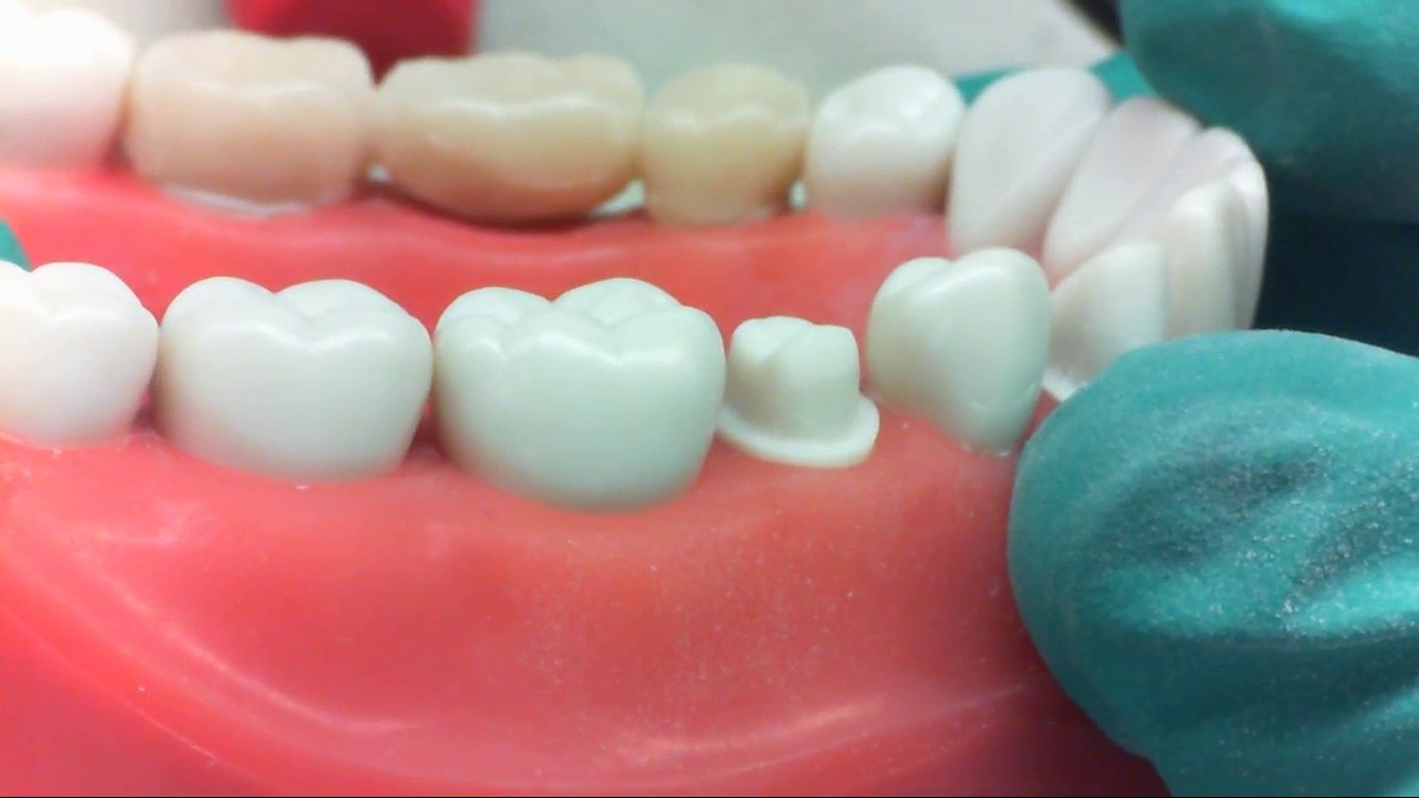 FPD Provisional - YouTube