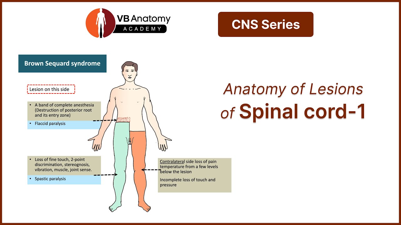 Anatomy of Lesions of spinal cord-Part 1 - YouTube