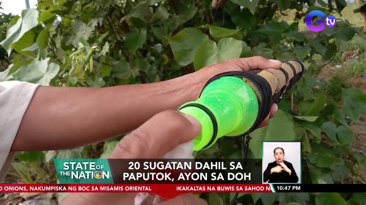 20 sugatan dahil sa paputok, ayon sa DOH | SONA - YouTube