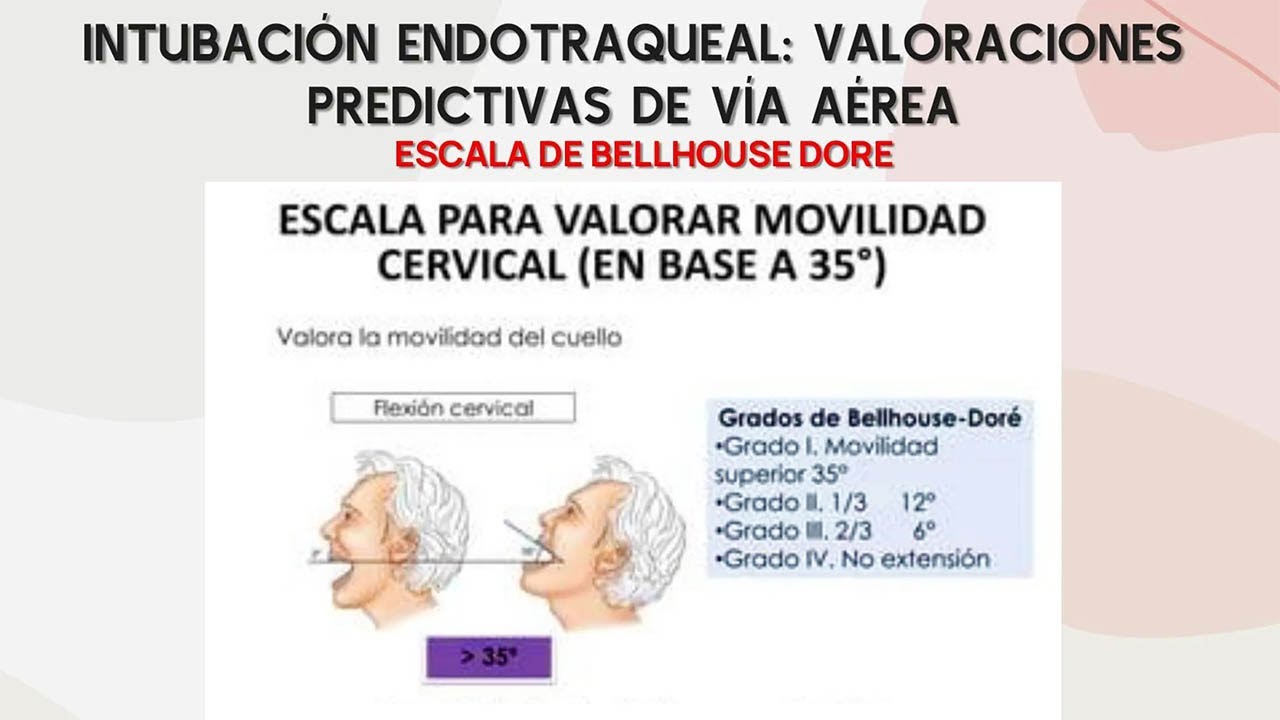 🔴 ESCALA DE BELL HOUSE DORE - YouTube