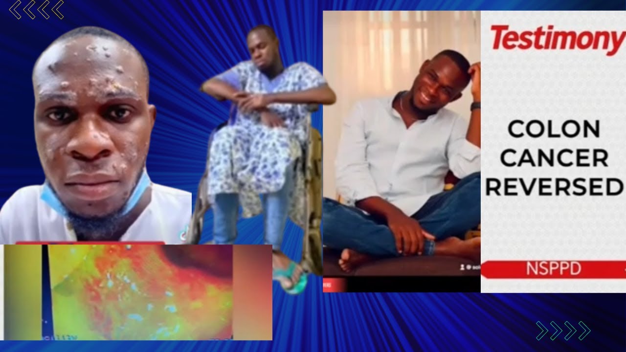 HEALED OF COLON CANCER - YouTube