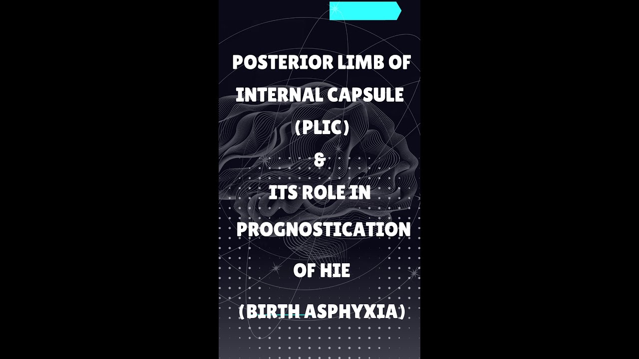 #Significance of PLIC in prognostication of term newborns with HIE ...