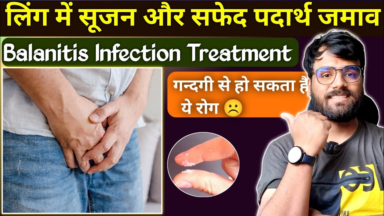 लिंग में सुजन और सफ़ेद पदार्थ जमना | balanitis treatment | penis ...
