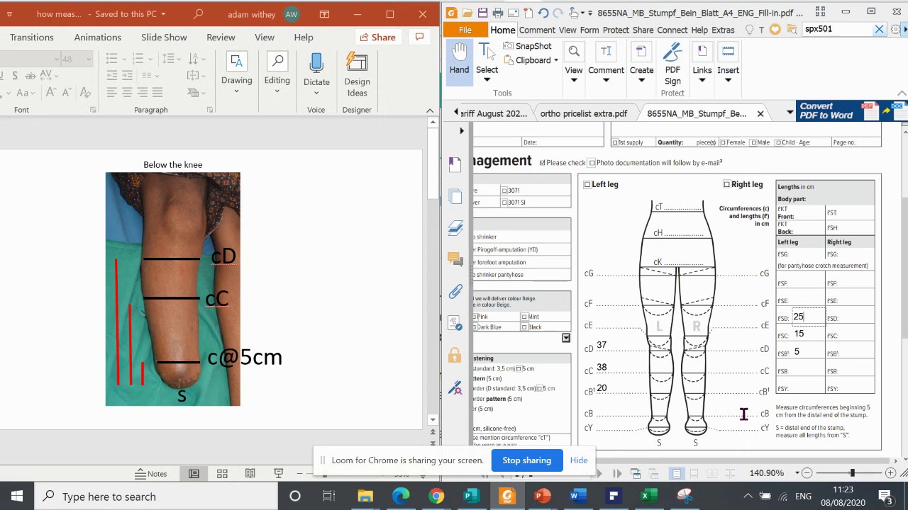 How to measure for a Juzo Stump Shrinker - YouTube