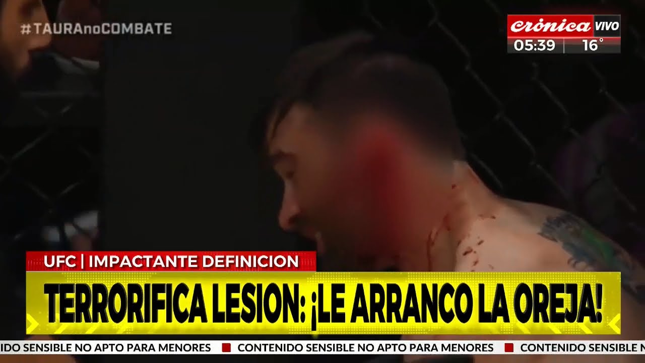 Tremendo: ¡Le arrancó la oreja en plena definición del UFC! - YouTube