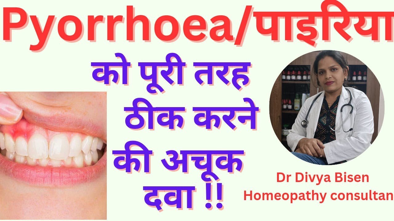 Homeopathy medicine for pyorrhoea/periodentitis.pyorrhoea treatment ...