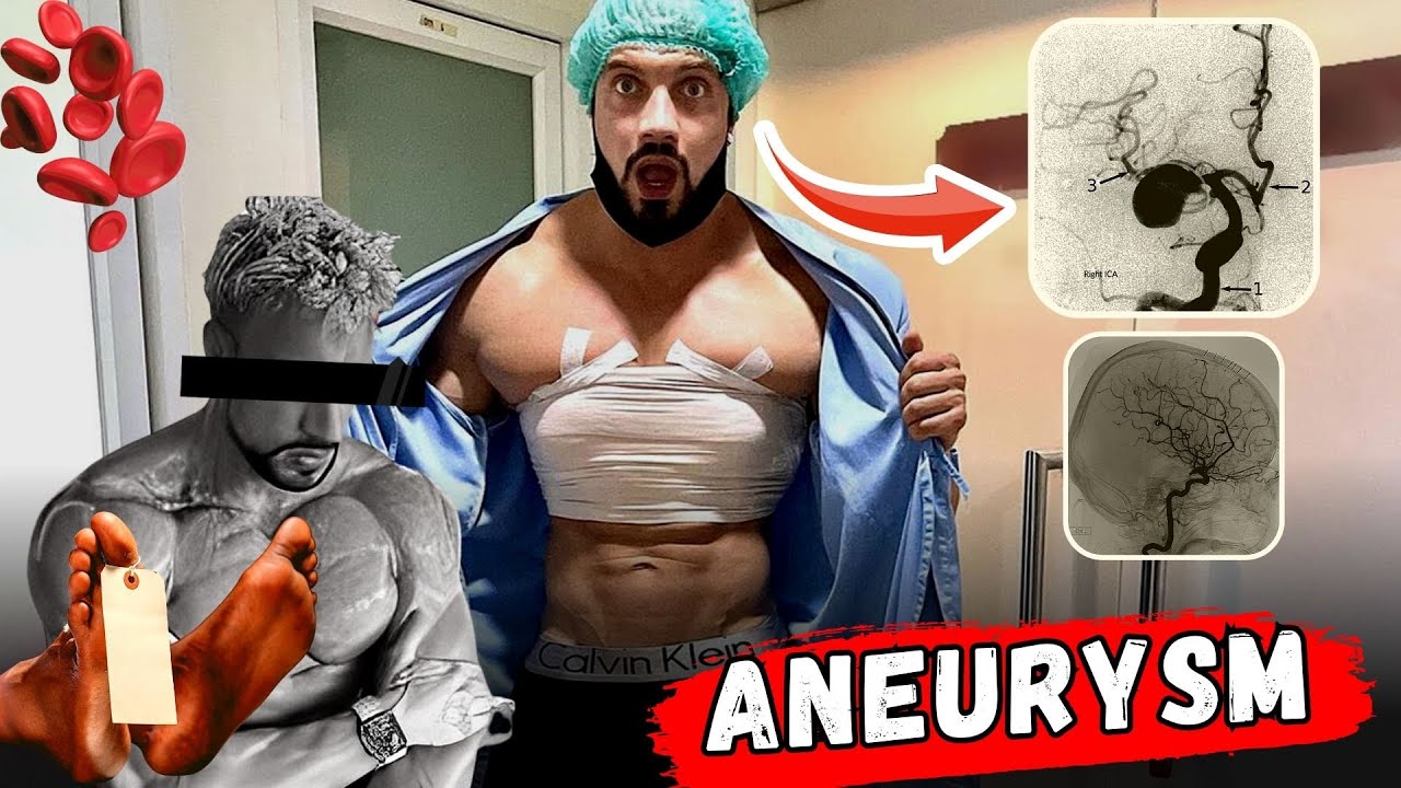 The SHOCKING TRUTH About The Death Of Joe Esthetics! - YouTube