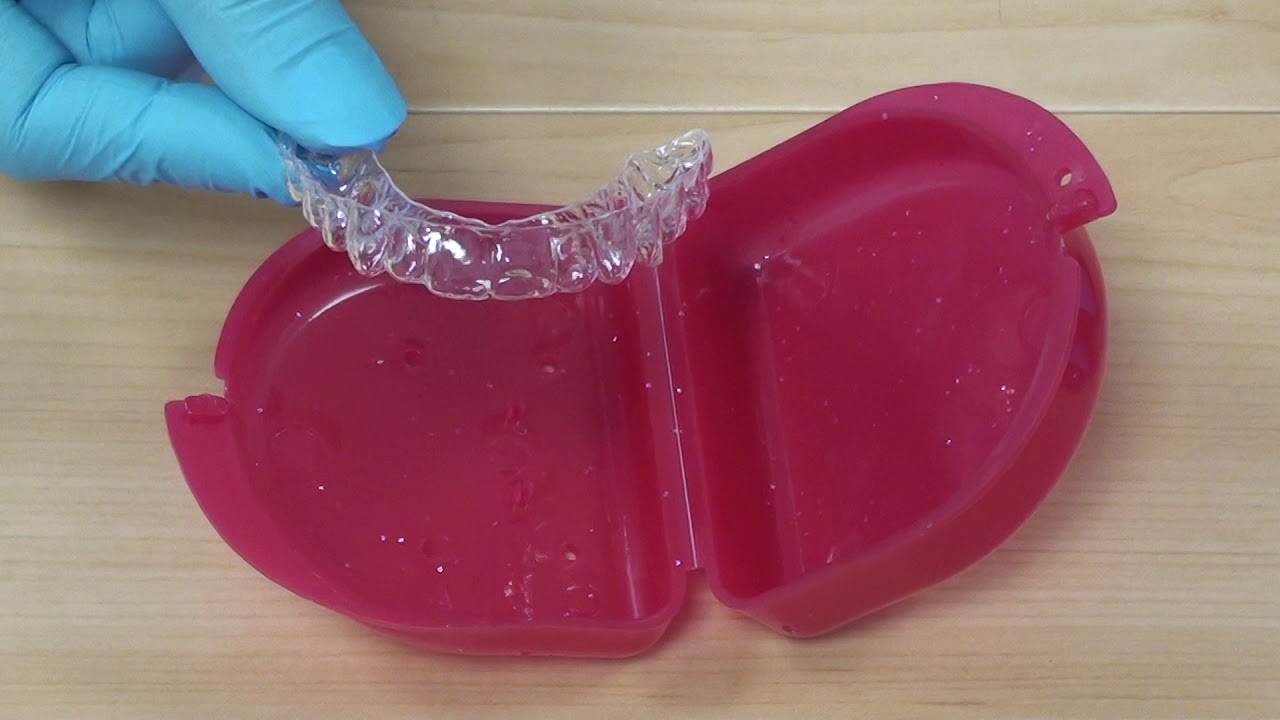 How to manage a broken fixed retainer. - YouTube