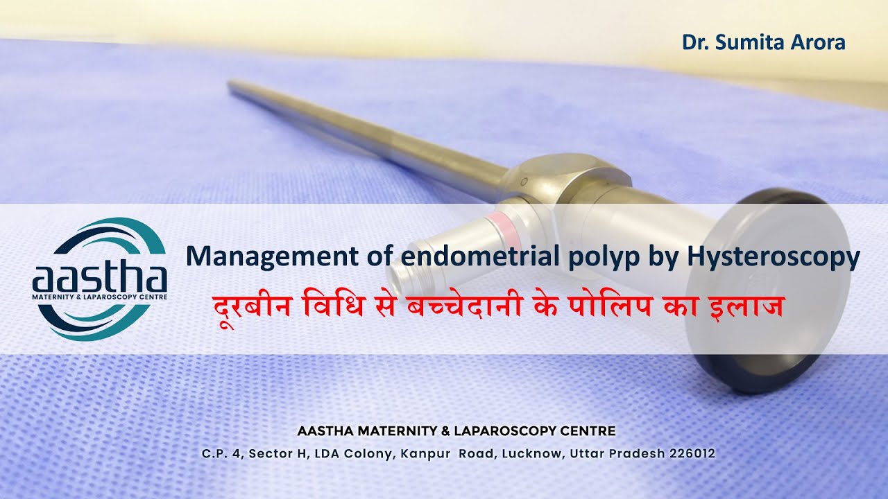 Hysteroscopic Polypectomy - YouTube
