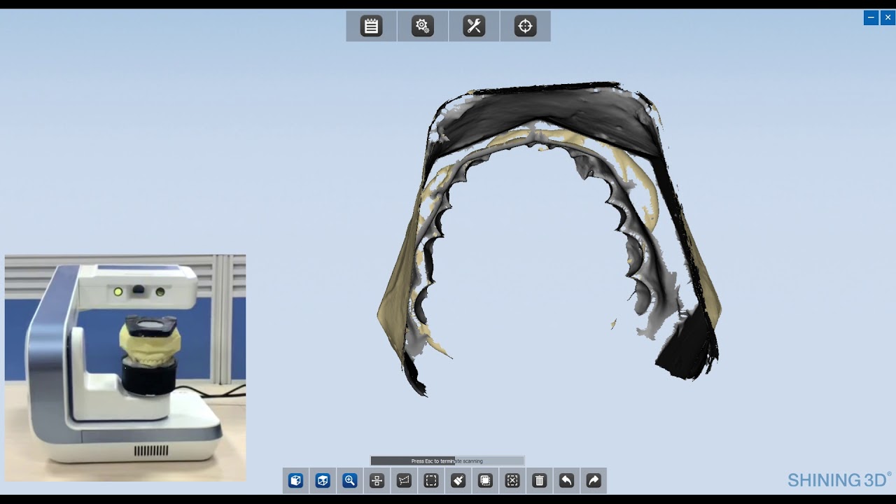 Shining 3D Autoscan DS-EX scanner dynamic bite occlusion transfer ...