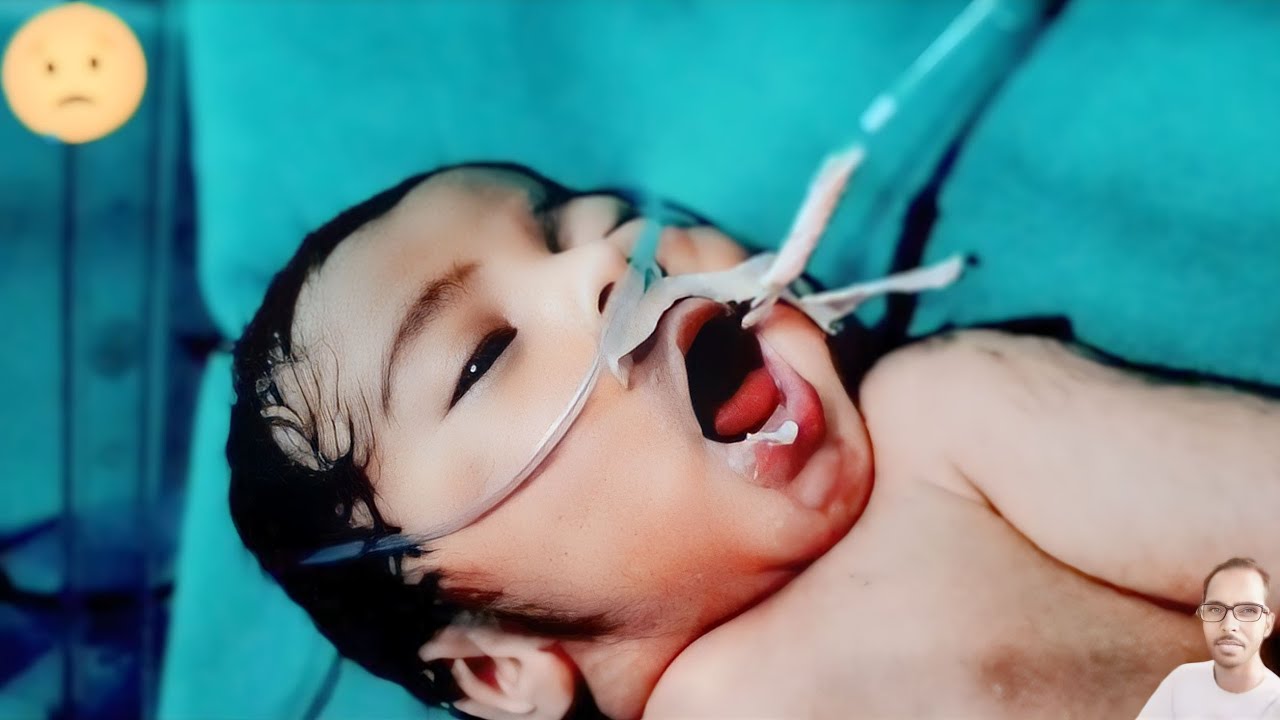 abnormal baby treatment/abnormal babies😢😢 @AfterBirth #baby #cute # ...