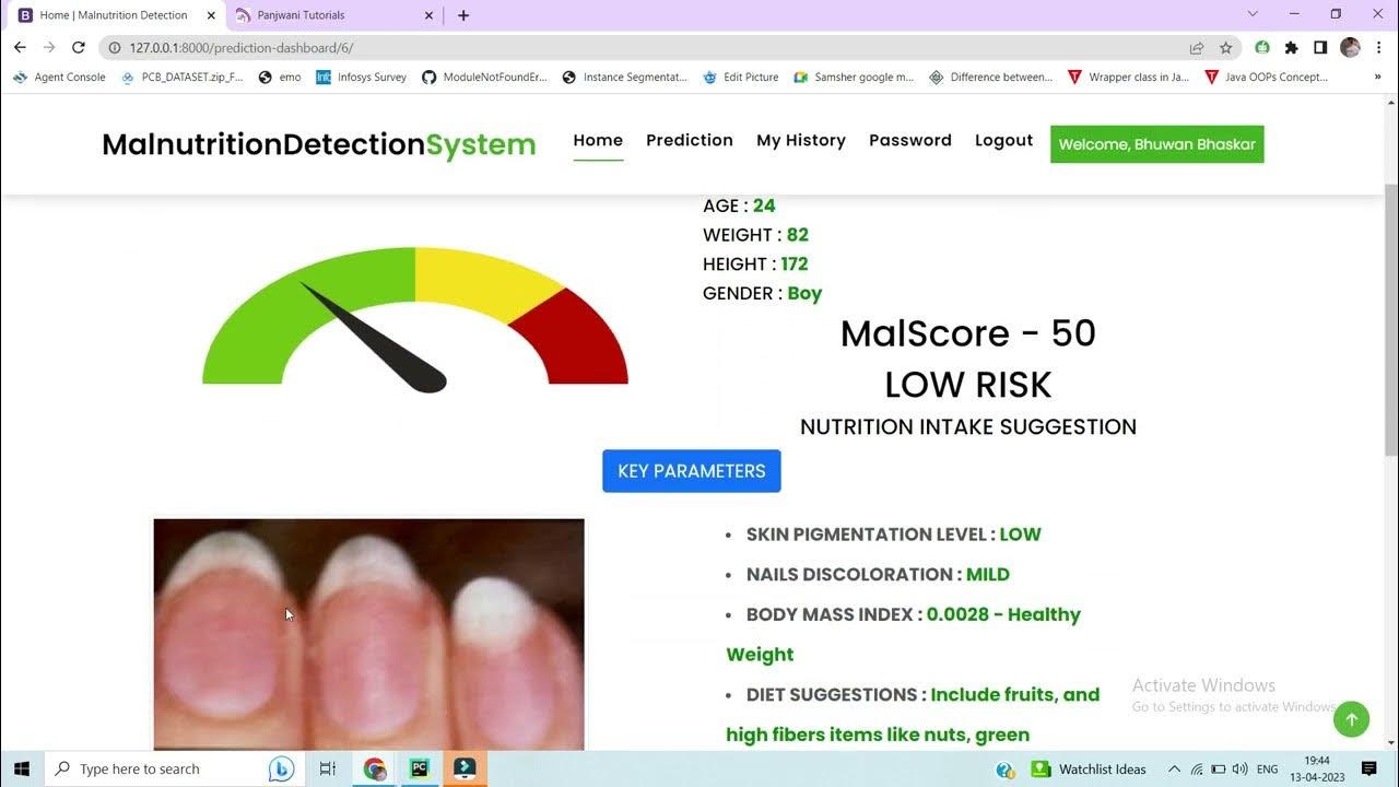Malnutrition Detection System Project using Deep Learning Python Django - YouTube