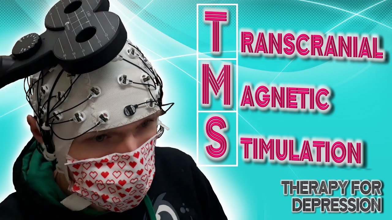 TMS For Depression - Basic Info: How Well TMS Works, Protocols, Side ...