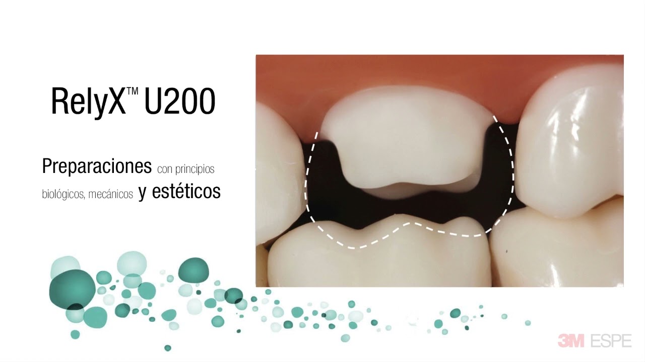 Tips RELYX U 200 - YouTube