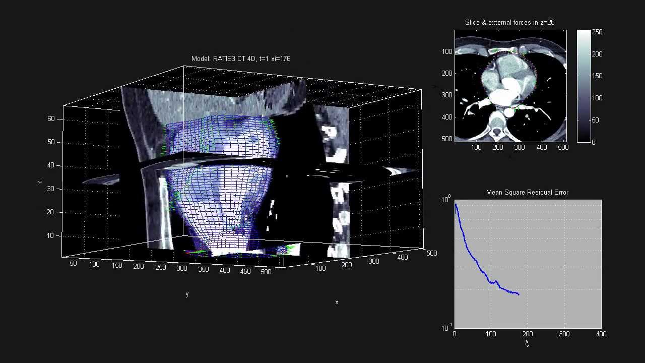 Segmentation Heart 4D CT BSpline Implicit min=22 max=254 - YouTube