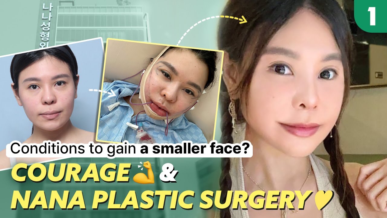 [SUB] Always wanted to have a smaller face? Join our patient's journey ...