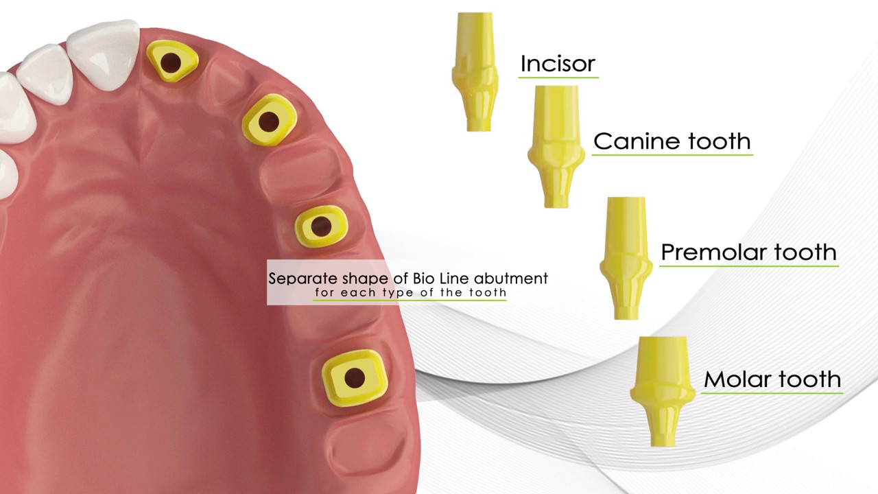 BioLine Prosthetics by Bio3 Implants - YouTube