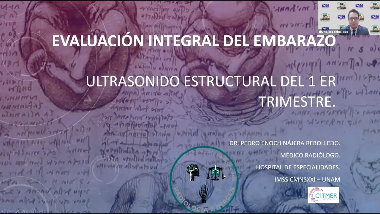 2 - 1 Ultrasonido Estructural Primer trimestre del embarazo | Dr ...