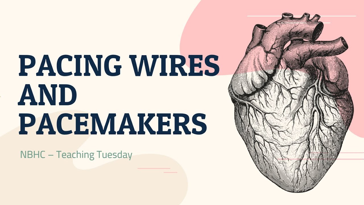 Pacing Wires and Pacemakers - YouTube