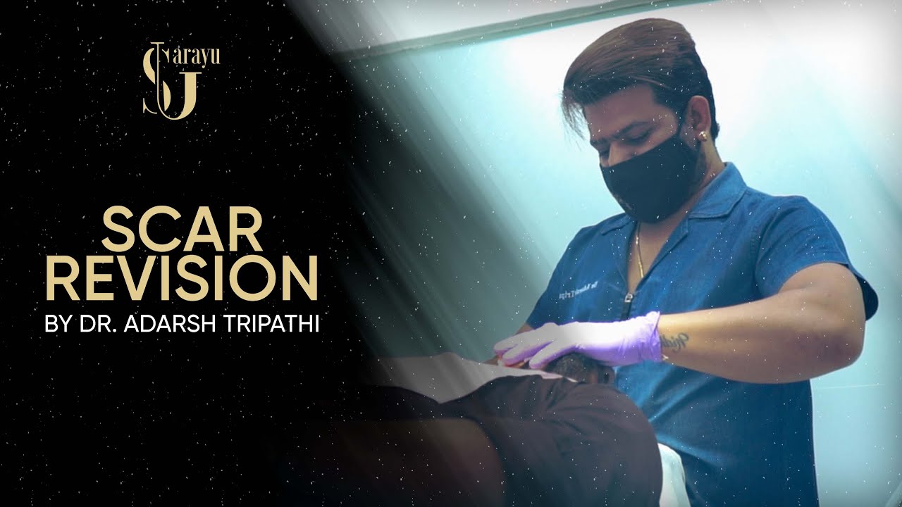 Scar Revision by Dr. Adarsh Tripathi - YouTube