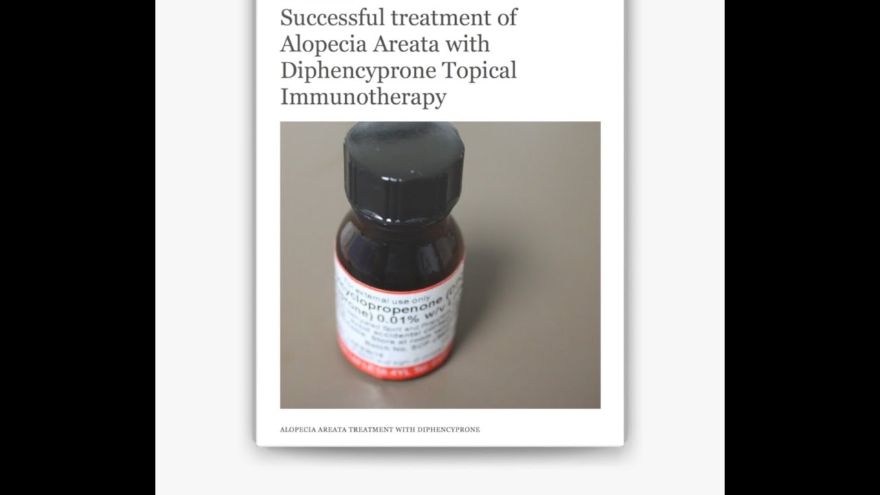 Pharmacology of Diphencyprone (Diphenylcyclopropenone) ; Mechanism of ...