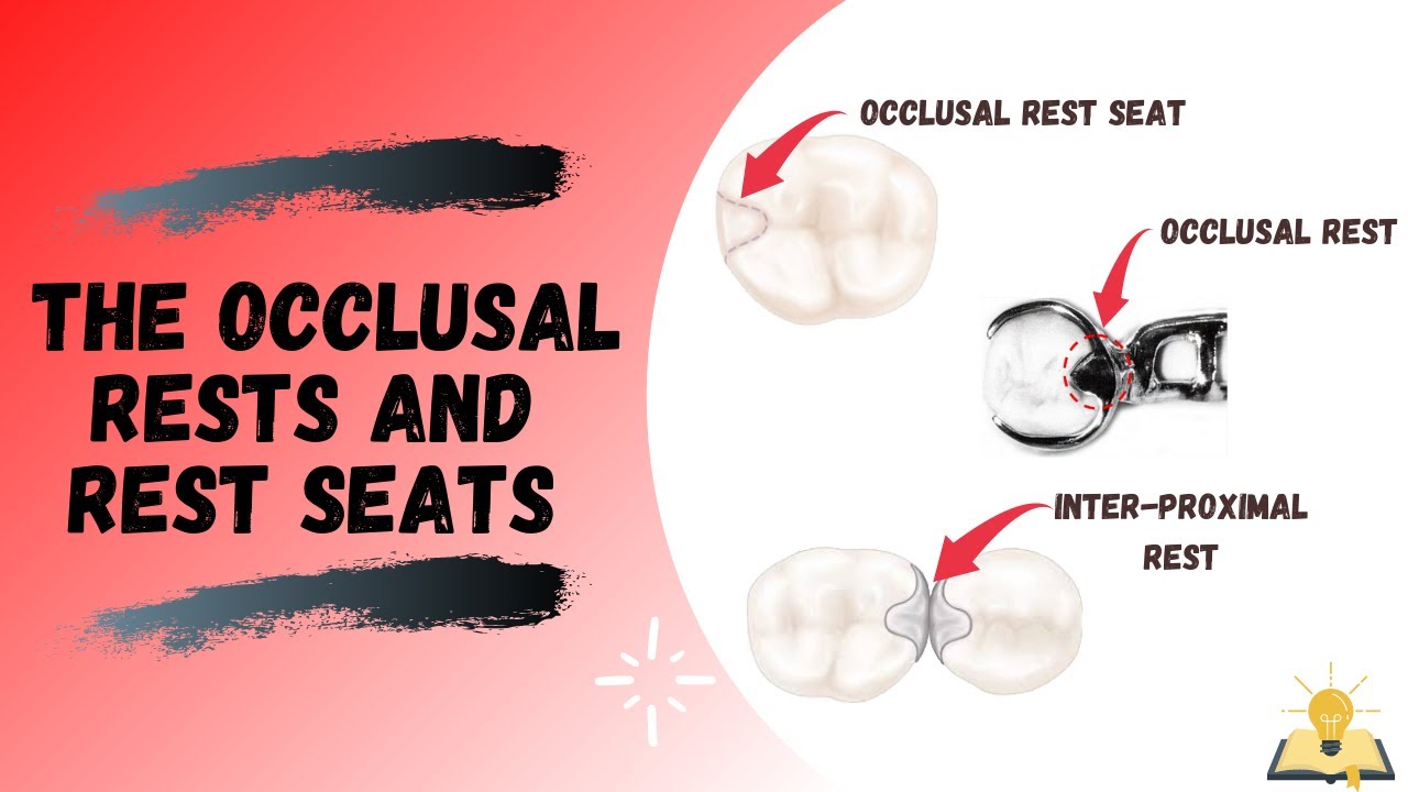 Occlusal Rest and Rest Seat | Part II | Removable Partial Denture (RPD ...