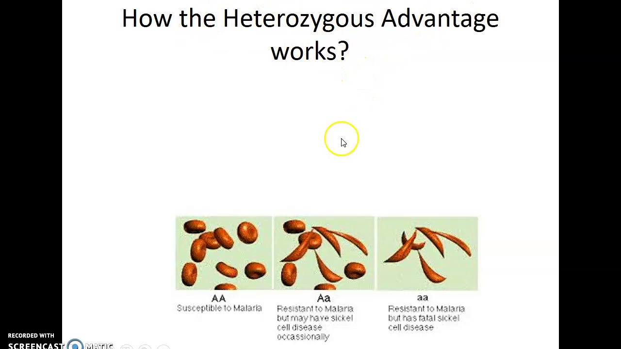 Heterozygote Advantage Sickle Cell Anemia