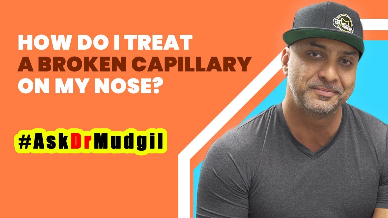 HOW DO I TREAT A BROKEN CAPILLARY ON MY NOSE? - YouTube