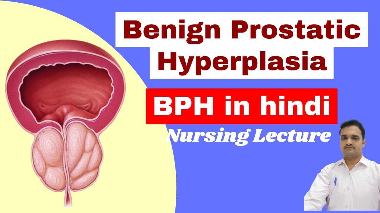 BPH msn bsc nursing 2nd year | Benign prostatic hyperplasia nursing ...