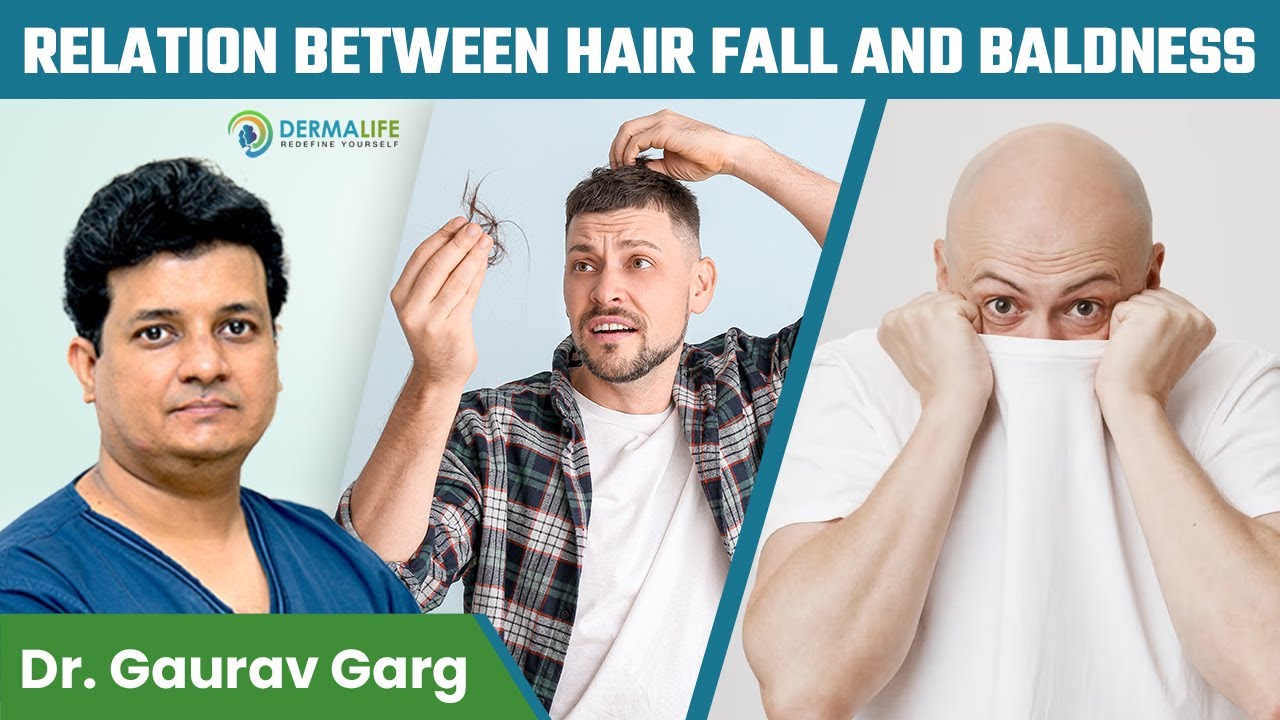 Difference between Hair Loss and Hair Fall | Relation Between Hair Fall ...
