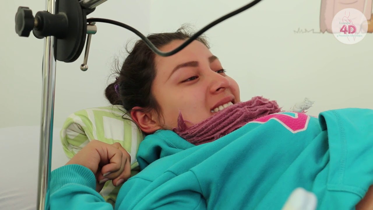 Ginecobstetra Dr Antonio Limay Ecografía 4D - YouTube