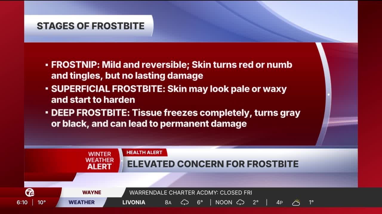 What you need to know about the 3 stages of frostbite - YouTube