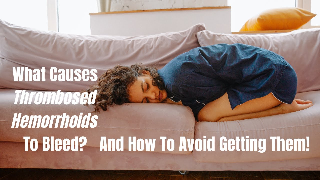 What Are Thrombosed Hemorrhoids? - YouTube