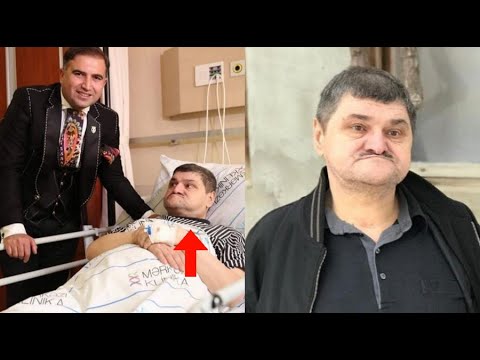 Meyxanaçı Ağakərim Kimdir?