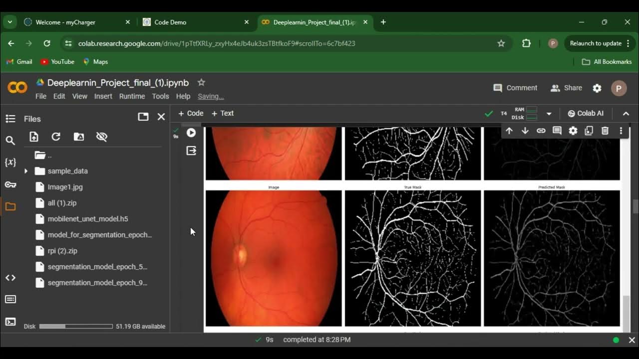 Retinal image classification Code Demo - YouTube