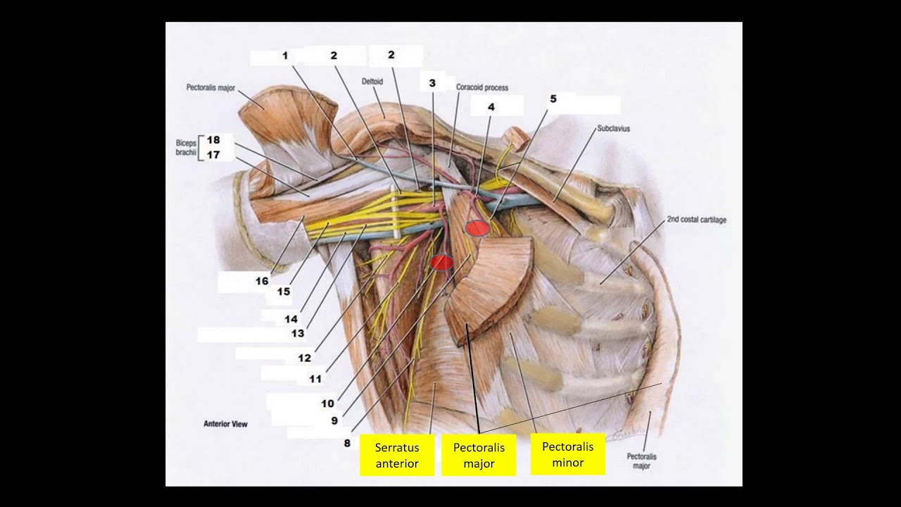 US Guided PECS Block Case - YouTube