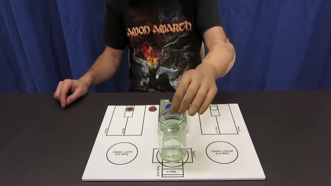 First bionic hand reconstruction - YouTube