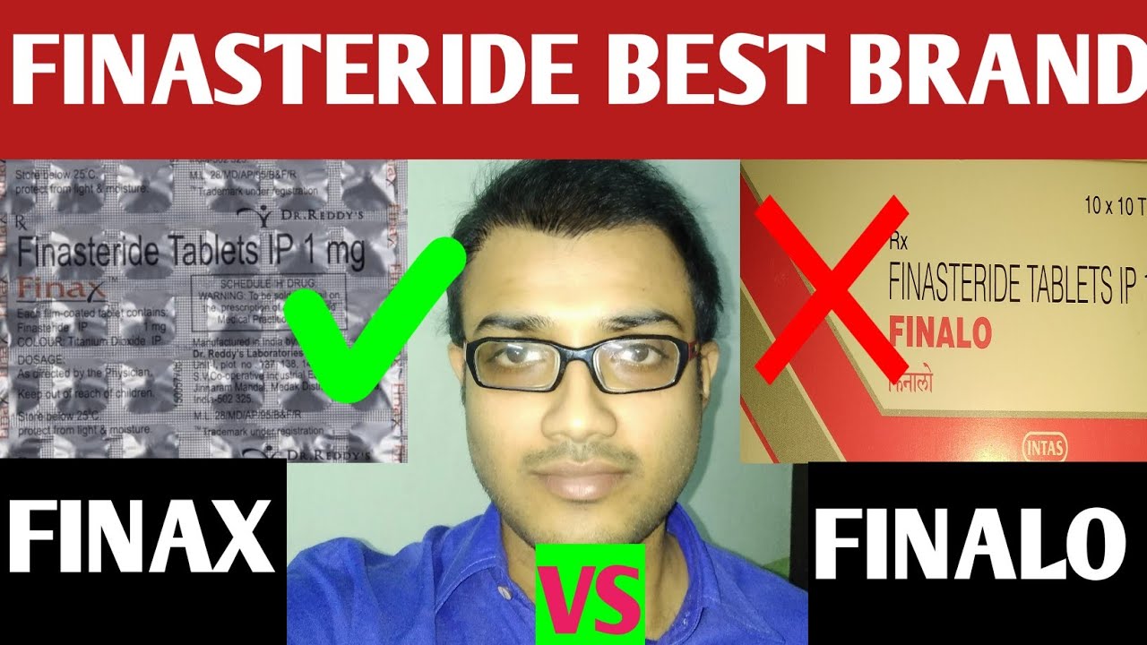 Finasteride best brand | Finasteride before and after | Finax vs finalo ...