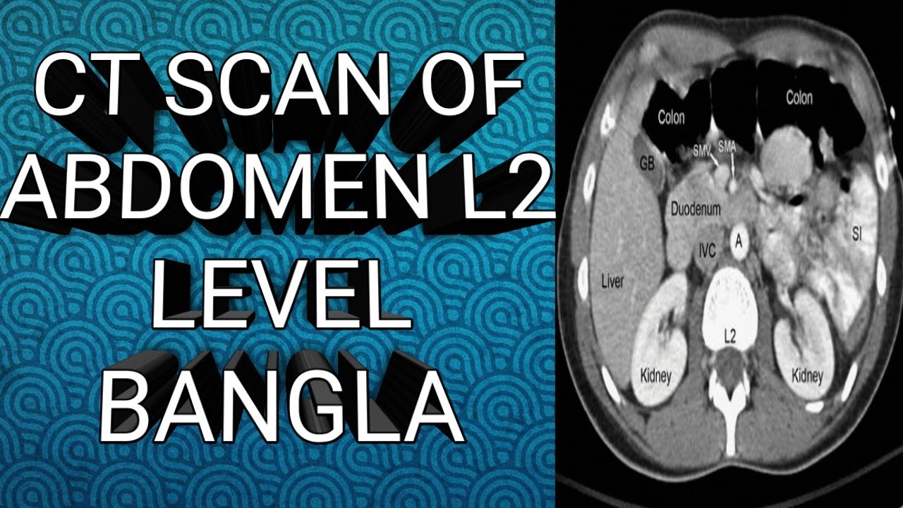 CT Scan Of Abdomen L2 Level _Bangla |Radiology| |Anatomy| #anatomy # ...
