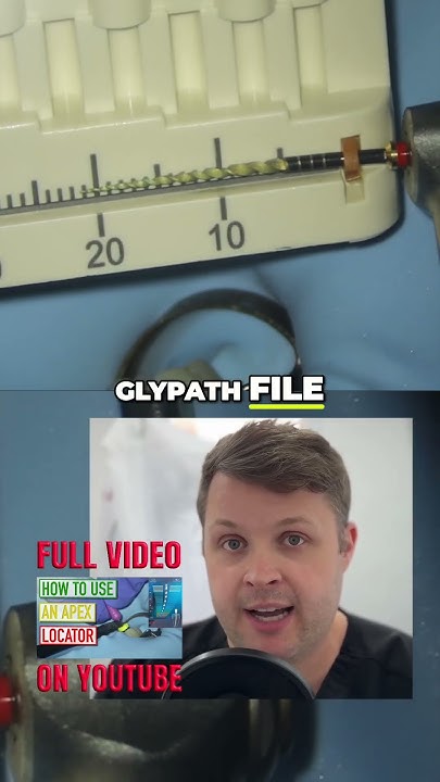 Mastering Glide Path Files Perfecting Canal Shaping - YouTube