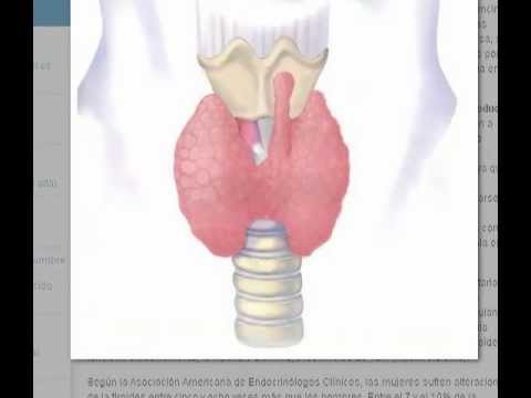 Complicaciones de la tiroidectomia - YouTube