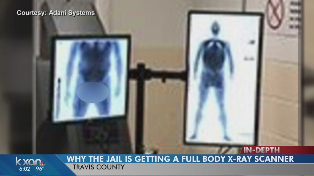 Travis County Jail to get new $112,000 full-body X-ray scanner - YouTube