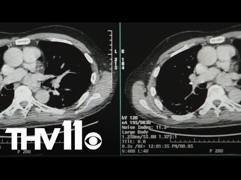 Contrast dye shortage impacting CT scans at hospitals - YouTube
