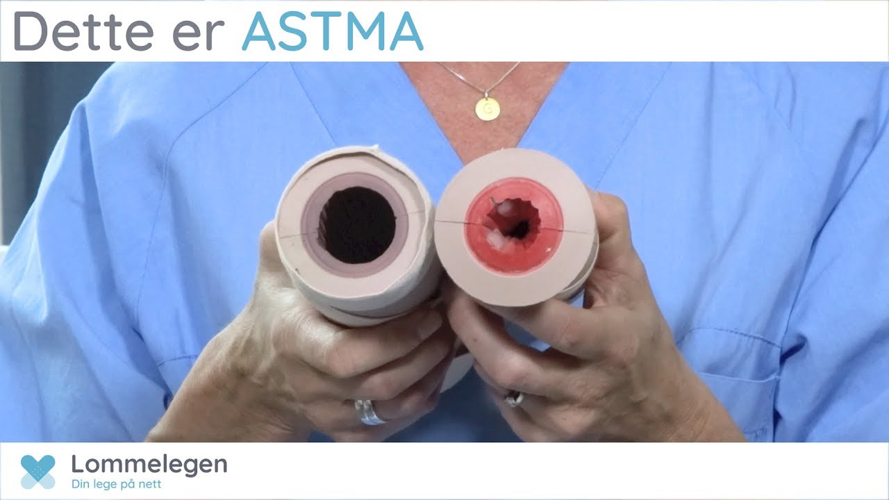 Dette er ASTMA - Lungesykdommer - Lommelegen - YouTube