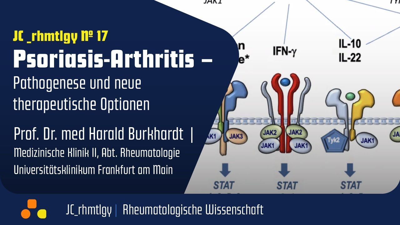 JC_rhmtlgy 17: „Psoriasis-Arthritis – Pathogenese und neue ...