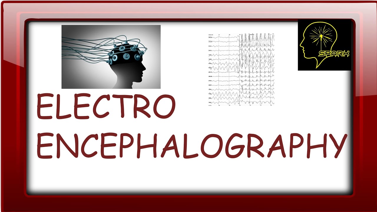 ELECTRO ENCEPHALOGRAPHY BASICS - PSYCHIATRY - YouTube