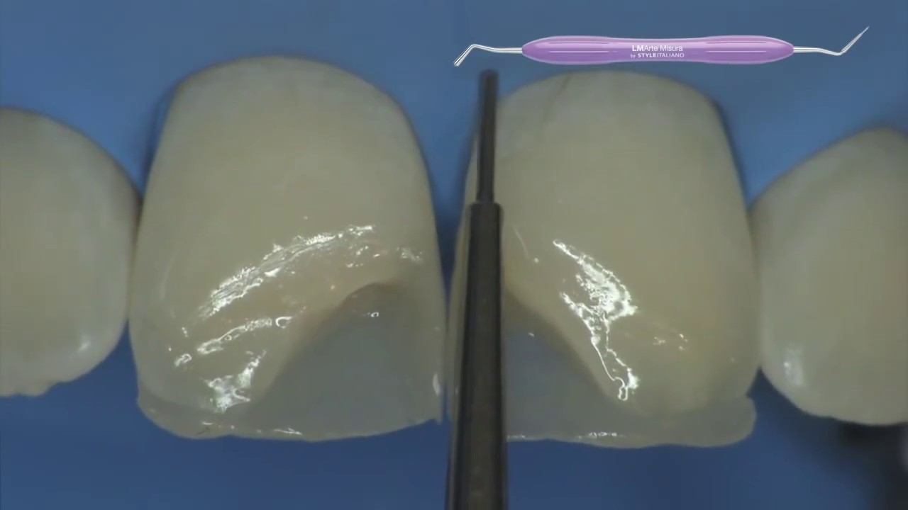 Style Italiano LM Arte Misura. A great dental instrument - YouTube